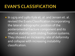 Evans Hip Fracture Classification