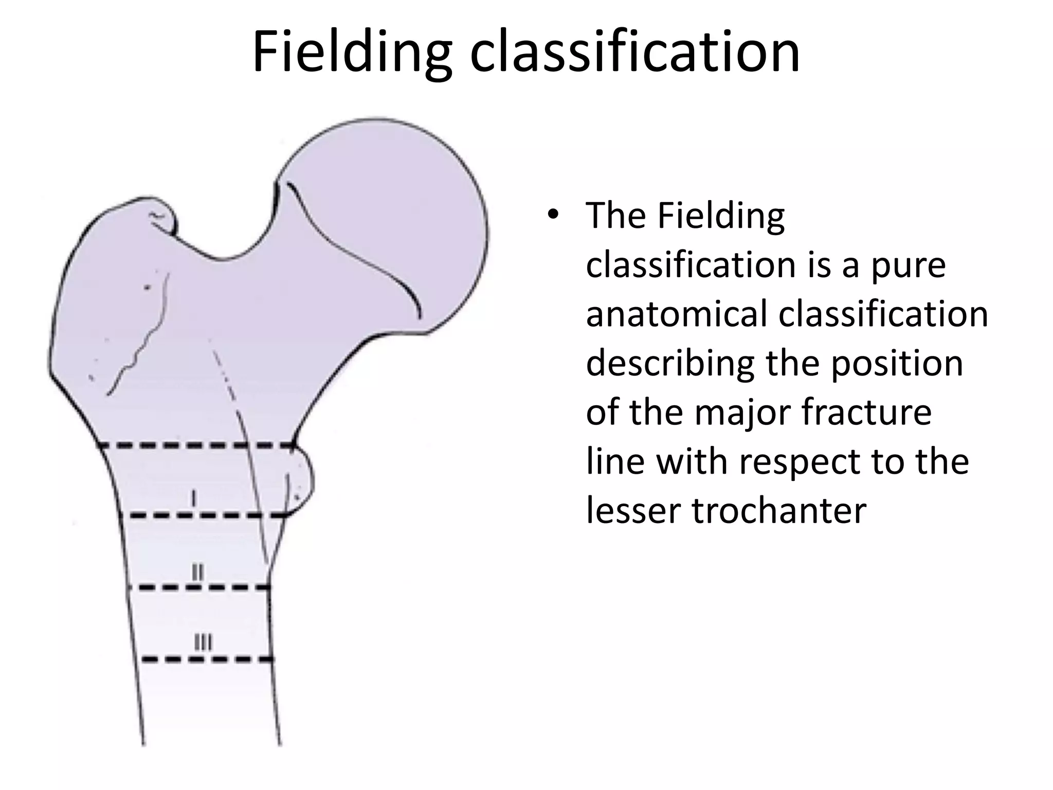 Intertrochanteric & subtrochanteric fracture classification | PPTX