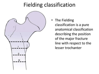 Intertrochanteric & subtrochanteric fracture classification | PPTX