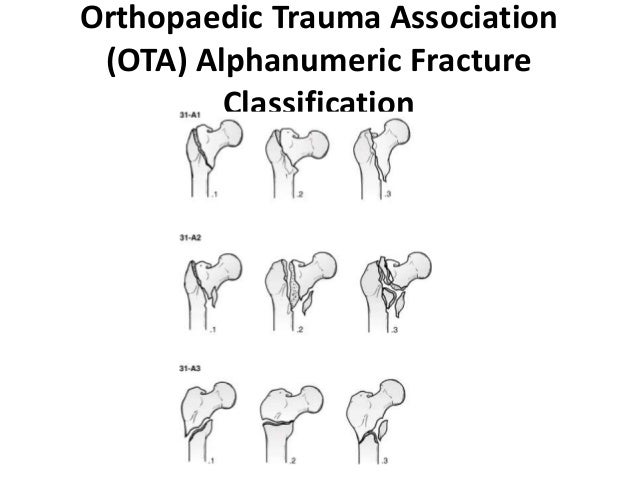 Intertrochanteric & subtrochanteric fracture classification