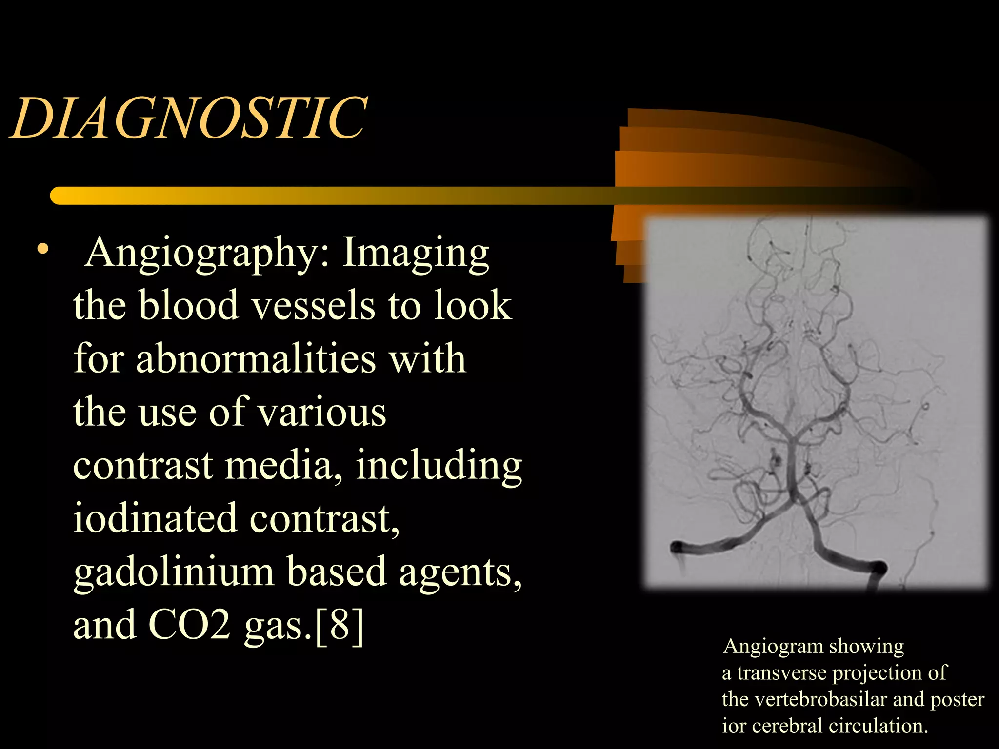 INTERVENTIONAL RADIOLOGY BY SAJID EJAZ | PPT