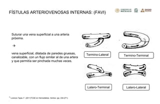 INTERVENCIONES DE ENFERMERIA EN PACIENTES CON HEMODIALISIS.pptx