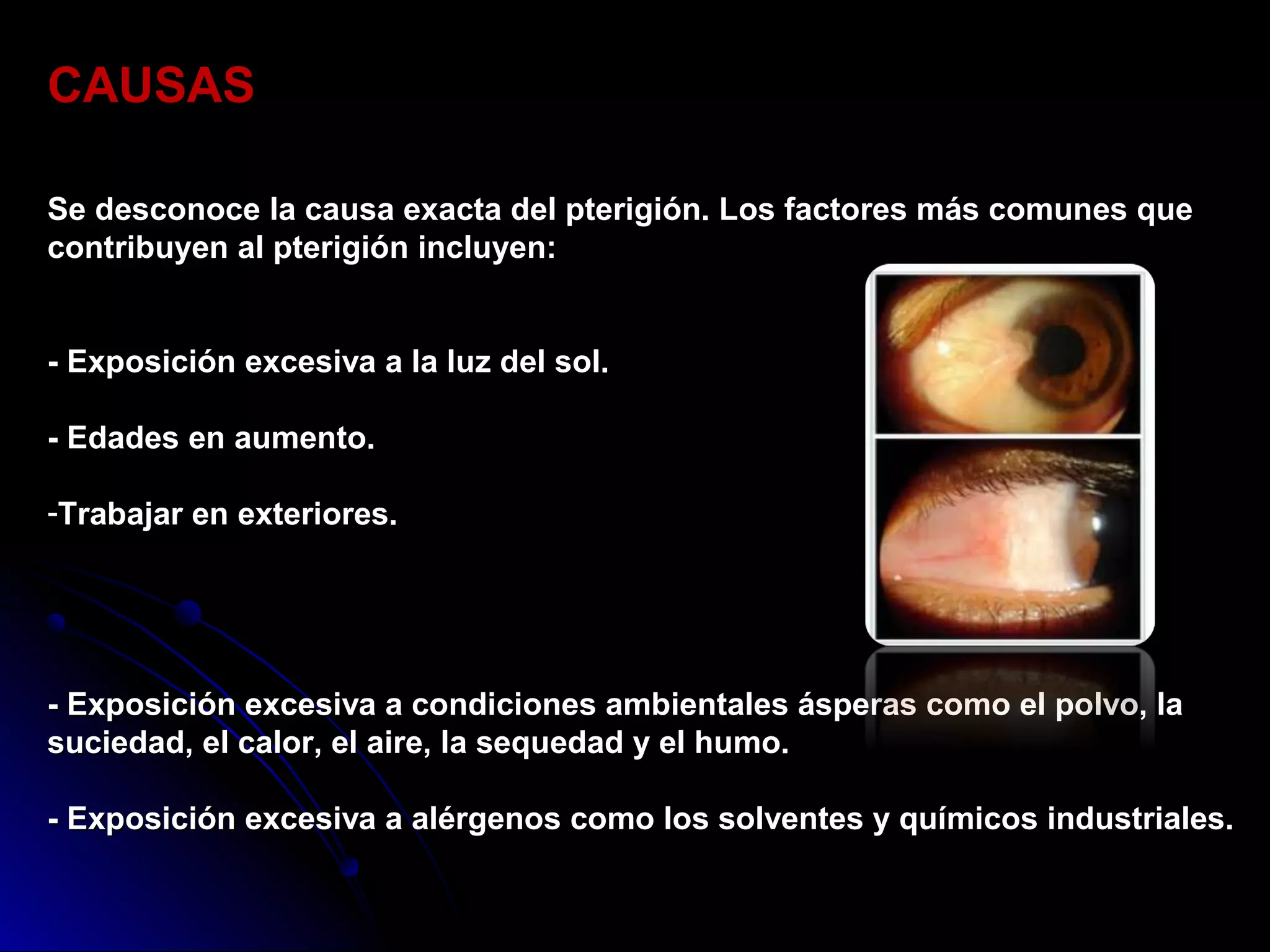 INTERVENCIÓN QUIRURGICA DE CATARATA , CHALAZION , PTERIGIÓN | PPT