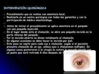 INTERVENCIÓN QUIRURGICA DE CATARATA , CHALAZION , PTERIGIÓN | PPT