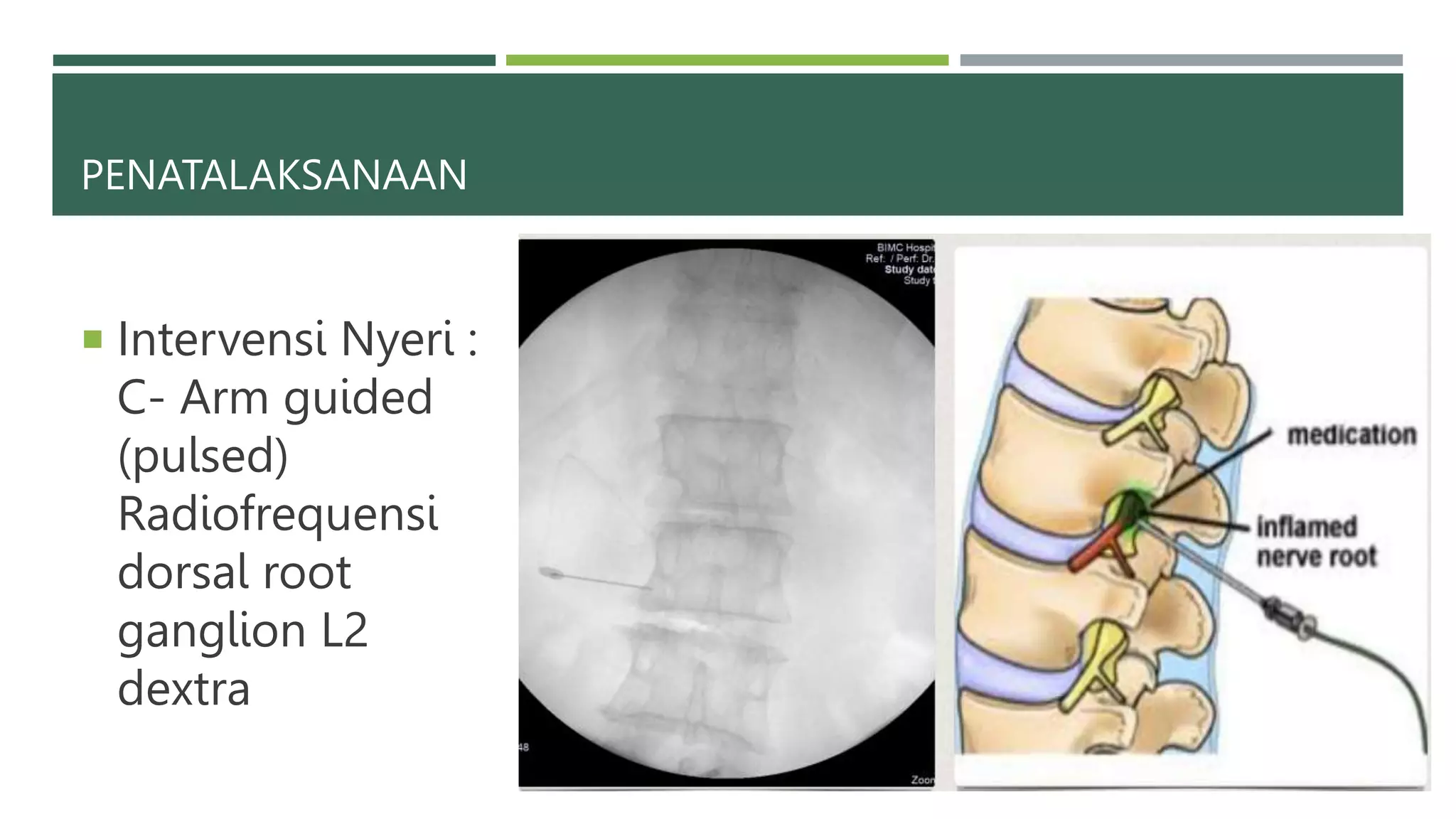 INTERVENSI NYERI PADA NYERI KRONIS YG.pptx | Free Download