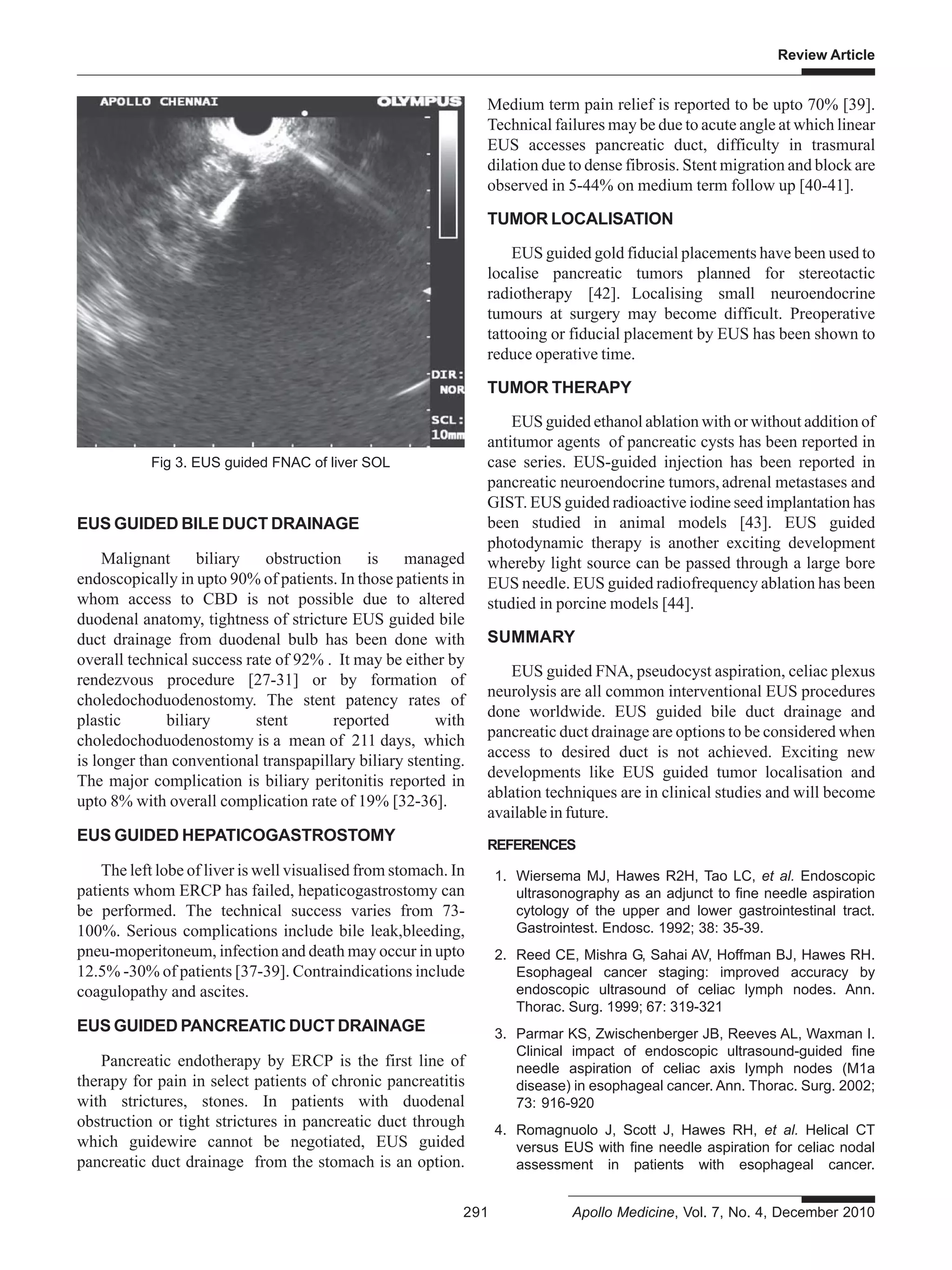 Interventional Endoscopic Ultrasound (EUS) | PDF