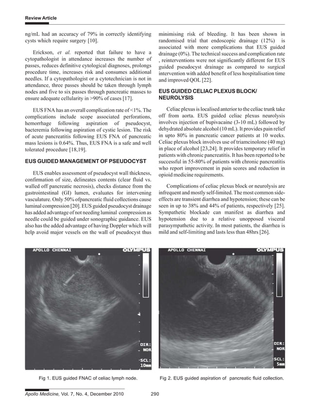 Interventional Endoscopic Ultrasound (EUS) | PDF