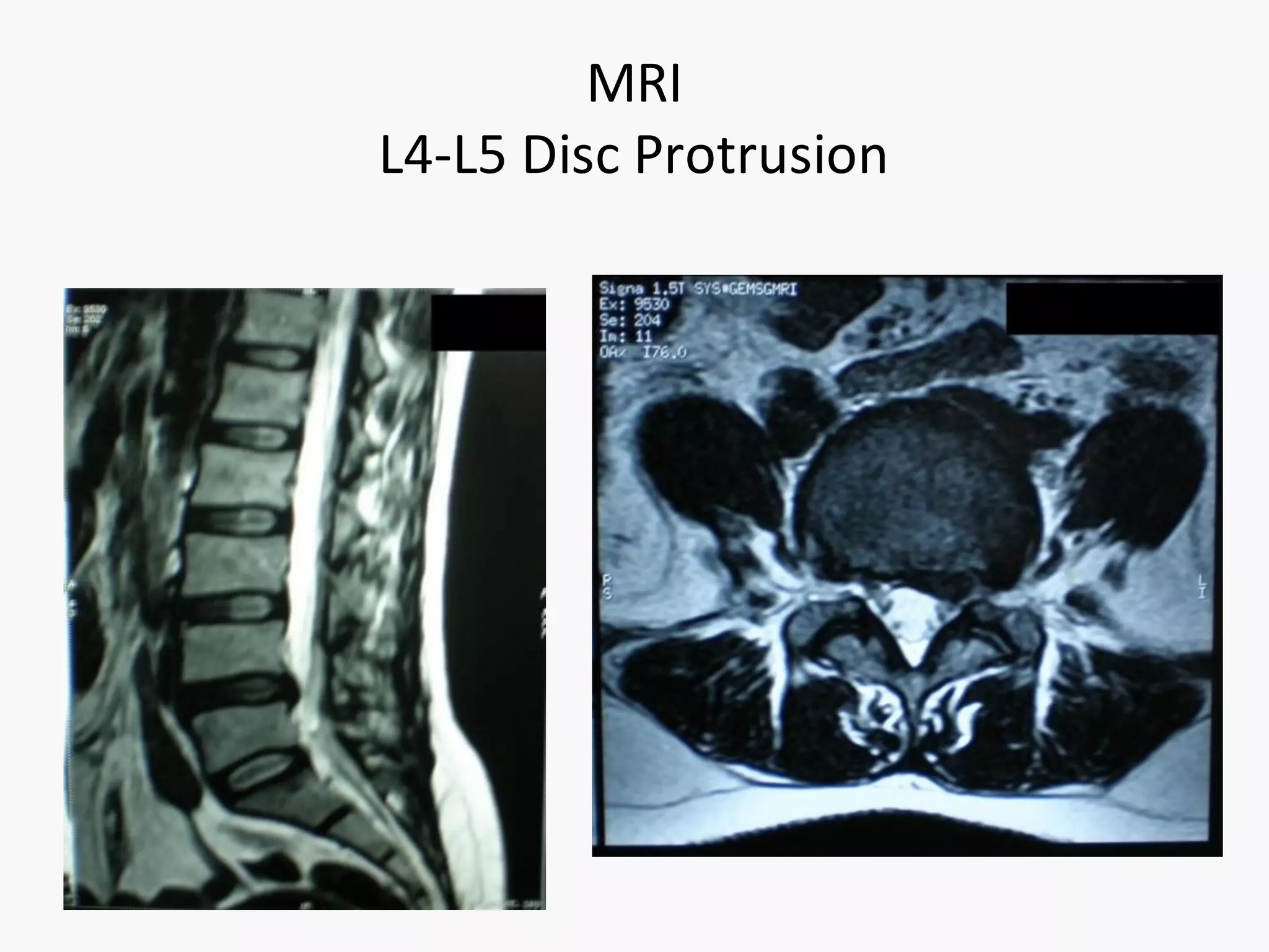 Interventional pain management | PDF