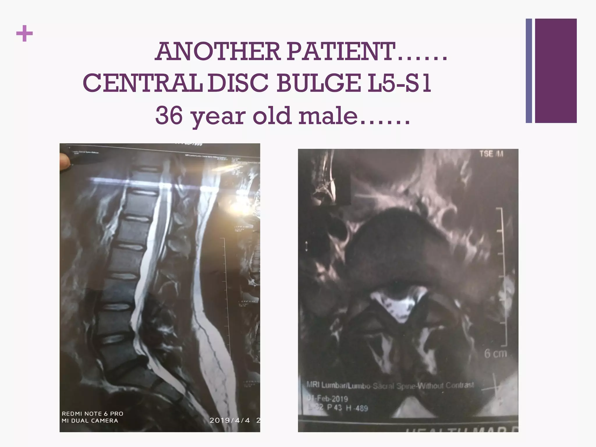 Interventional pain management | PDF