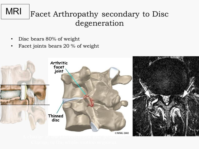 Interventional pain management | PDF