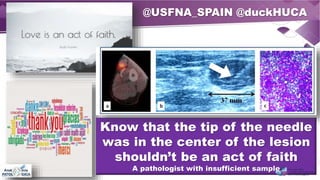 Interventional pathologist Ultrasound guided fna performed by ...