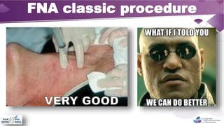 Interventional pathologist Ultrasound guided fna performed by ...