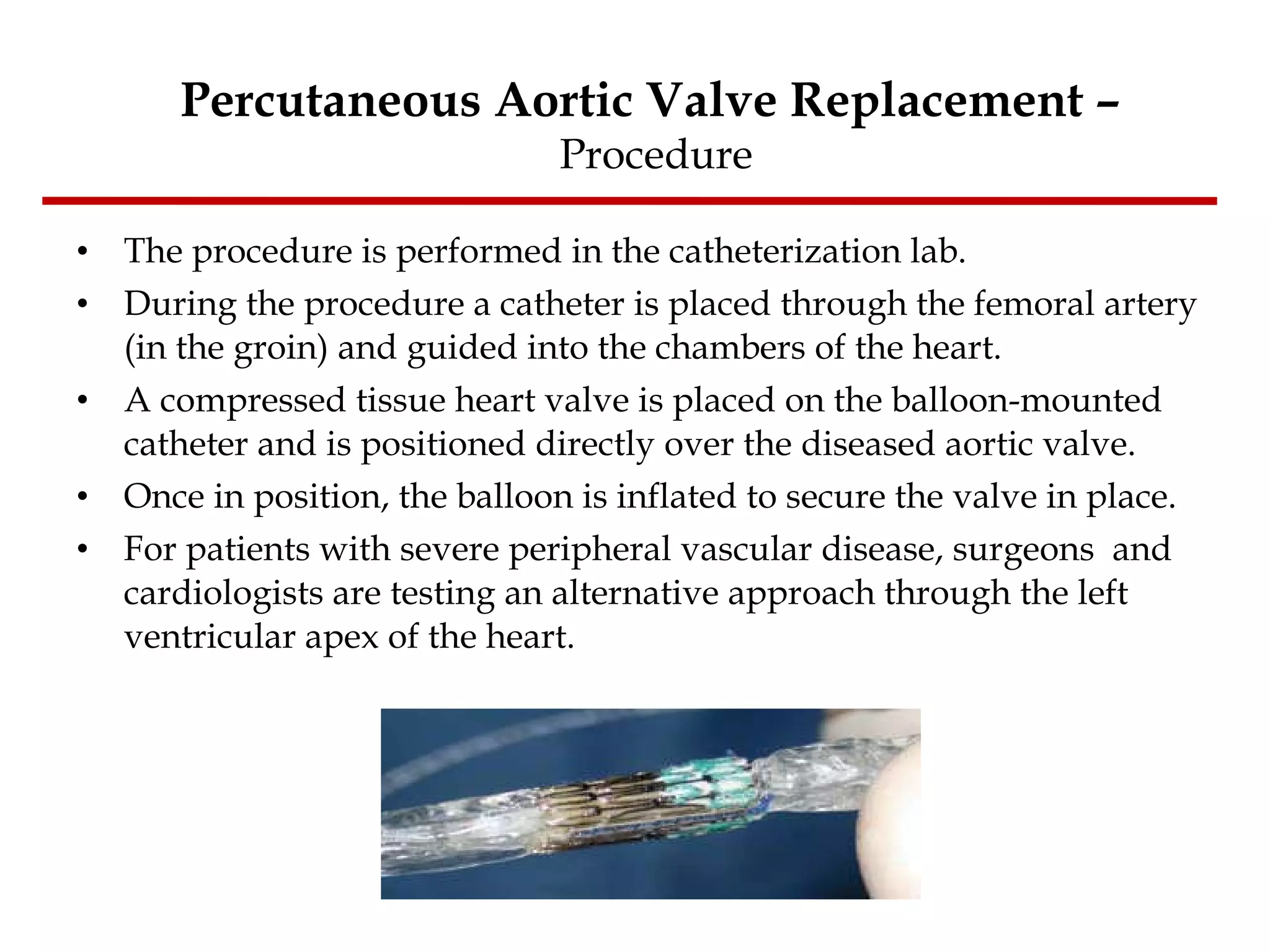 Interventional+Procedures | PPT