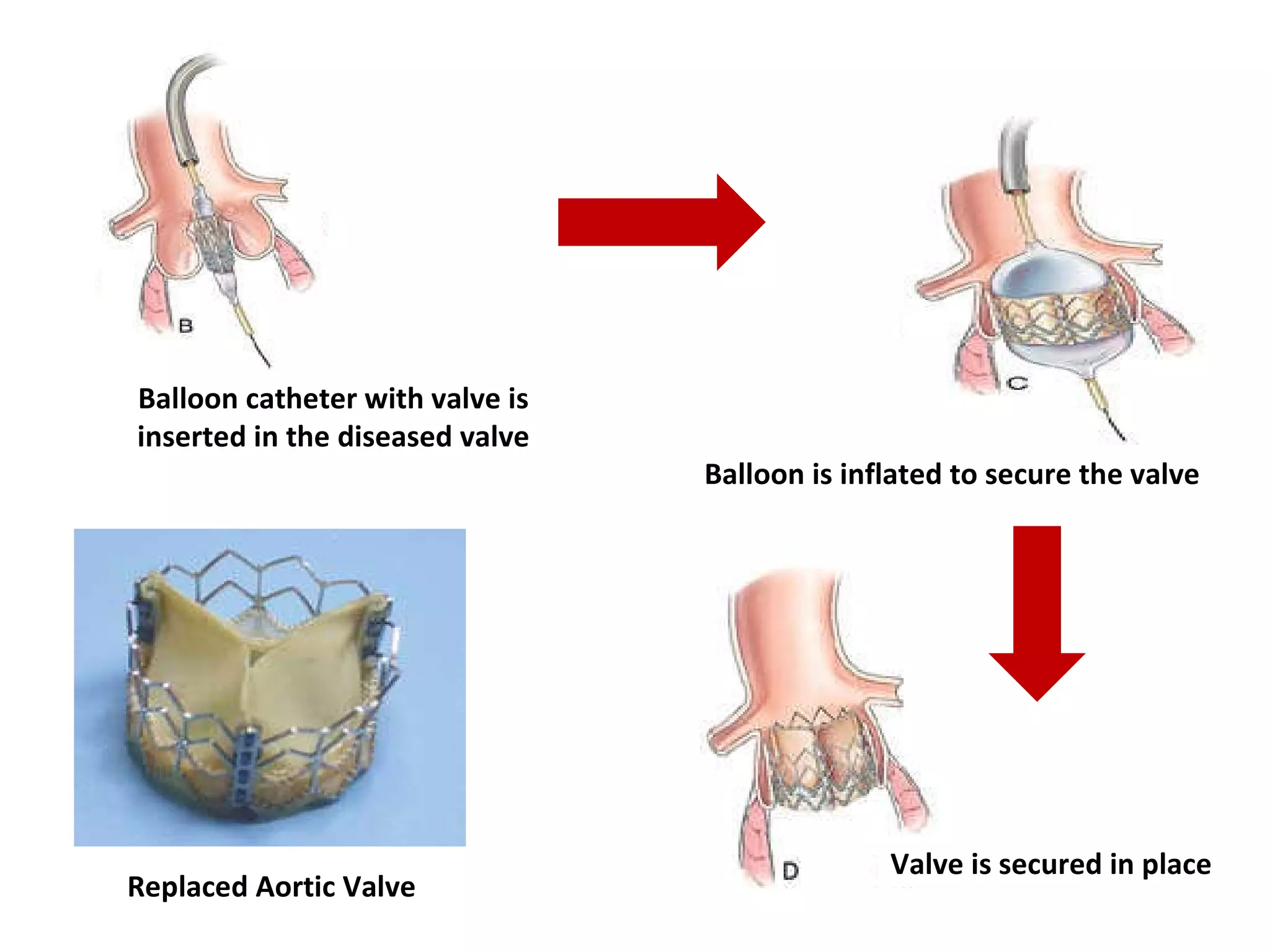 Interventional+Procedures | PPT