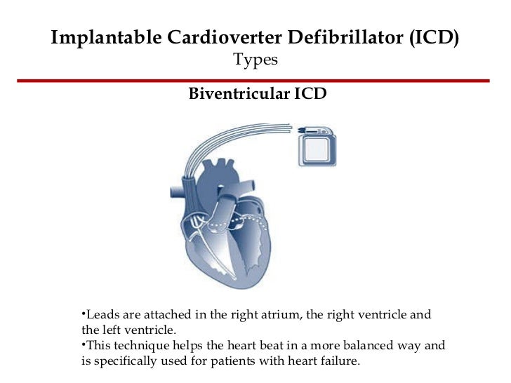 Interventional+Procedures