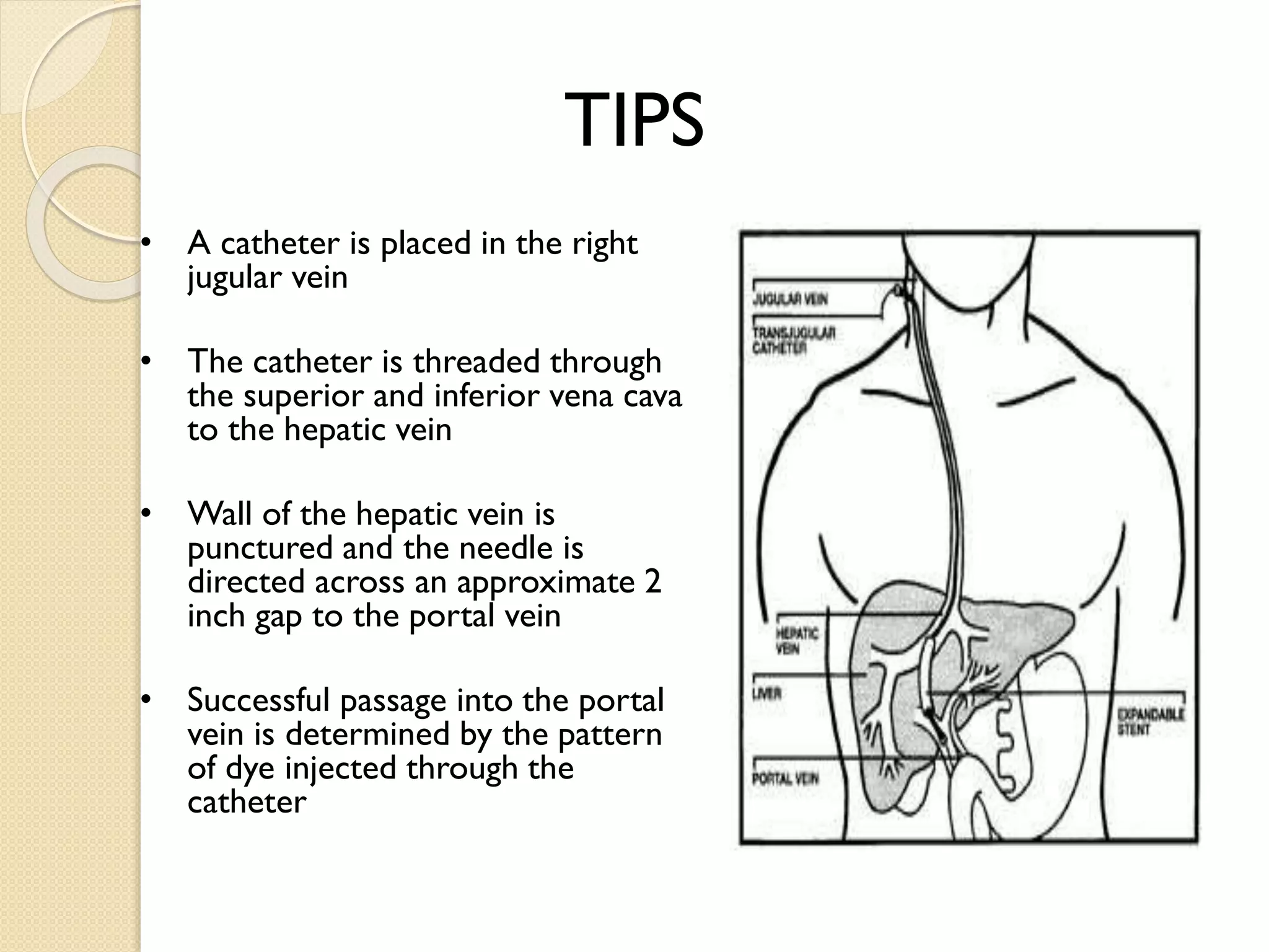 Interventional procedures in hepatobiliary system | PPTX