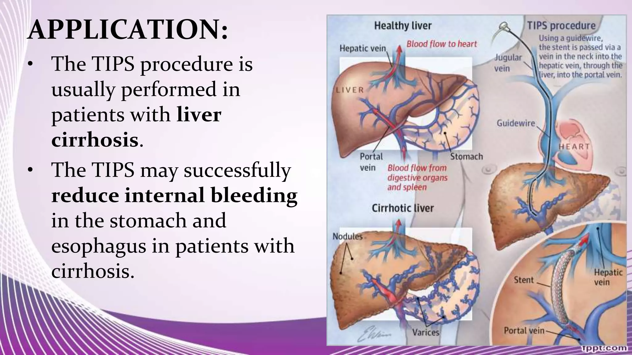 Interventional Radiology And Cardiology | PPTX