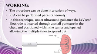 Interventional Radiology And Cardiology | PPTX