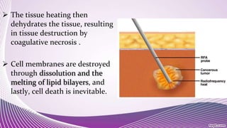 Interventional Radiology And Cardiology | PPTX