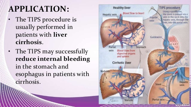 Interventional Radiology And Cardiology