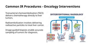 Interventional Radiologyfor MRI , CT scan , ultrasonography | PPTX