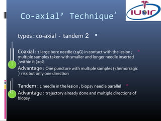 Interventional radiology1 | PPT | Medical Tests | Medical Health