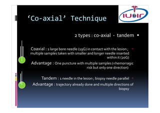 Interventional radiology1 | PPT