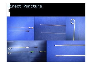 Interventional radiology2 | PDF