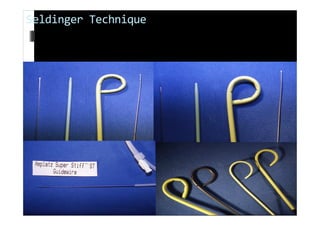 Interventional radiology2 | PDF