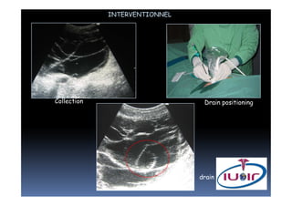 Interventional radiology2 | PDF