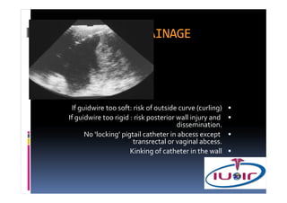 Interventional radiology2 | PDF