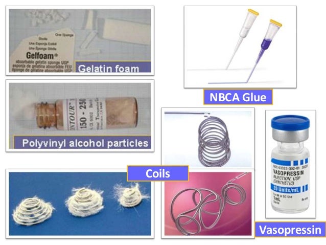 Interventional radiology in the management of gastrointestinal bleedi…