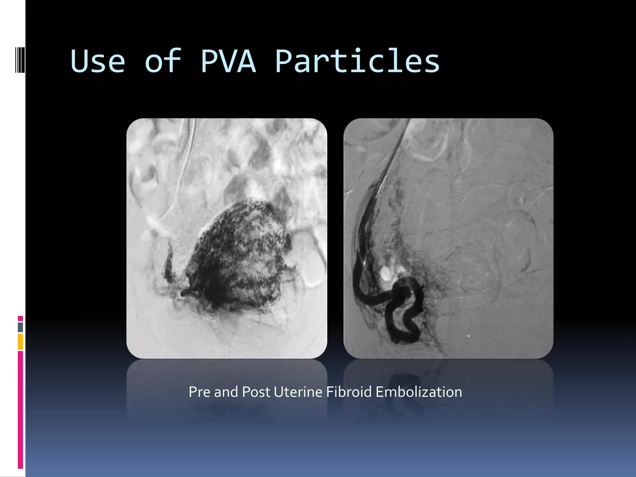 interventionalradiologypart1-170807180227.pdf