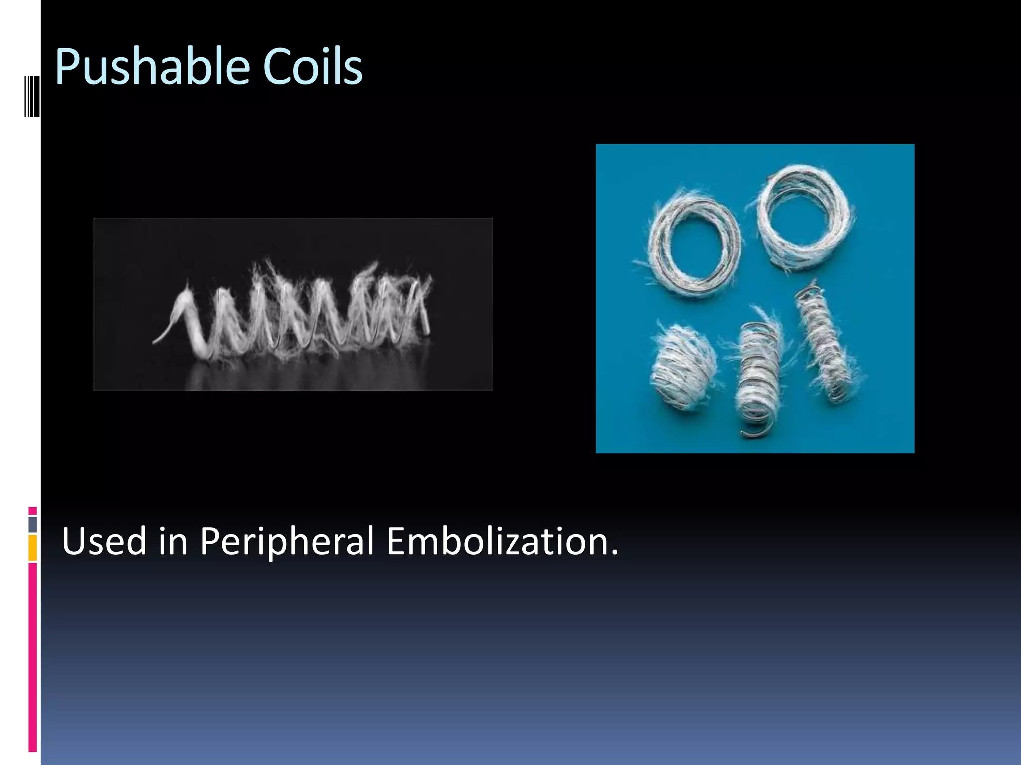 interventionalradiologypart1-170807180227.pdf