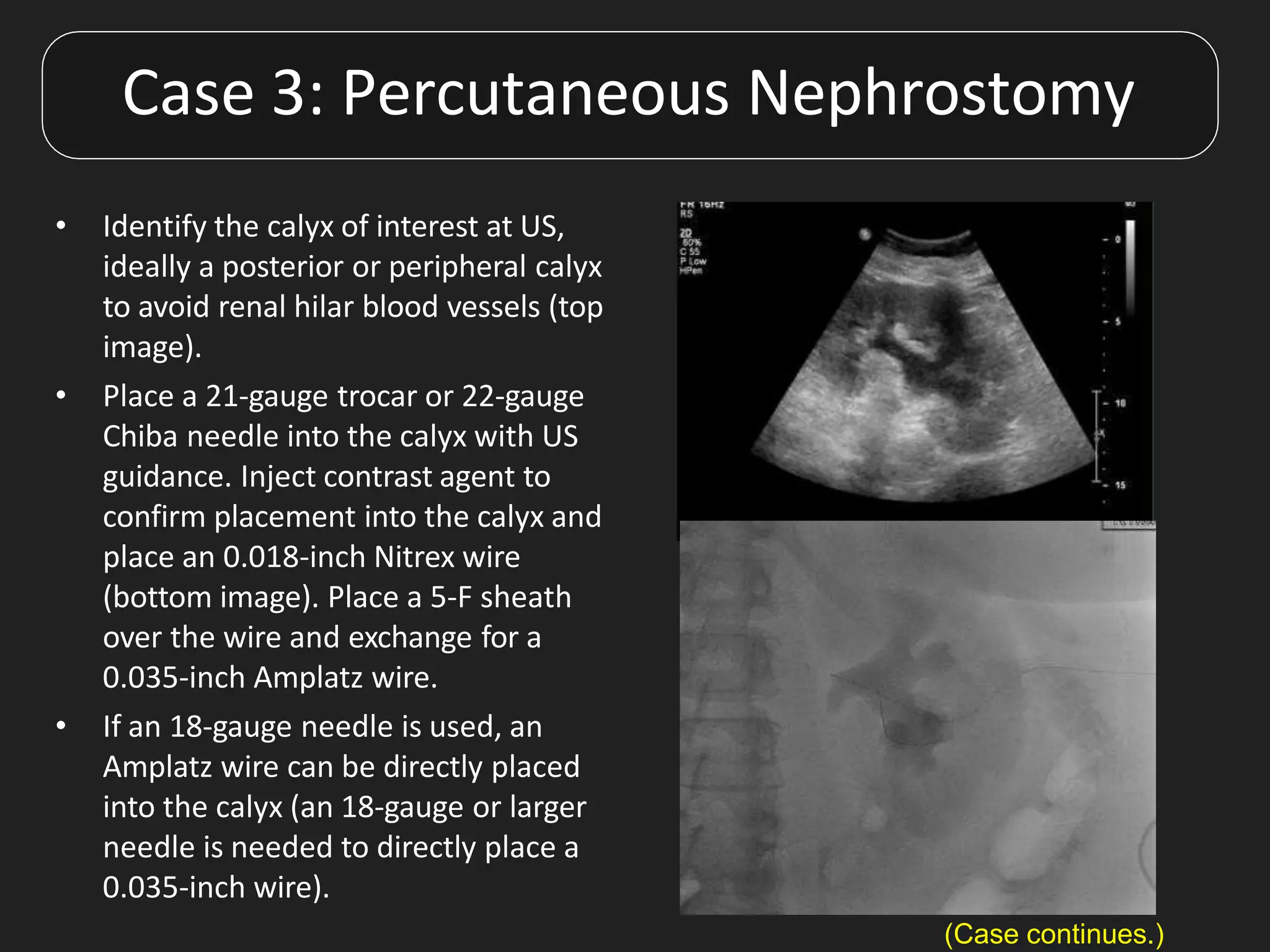 Interventional Radiology Powerpoint Pptx