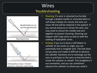 Interventional Radiology Powerpoint.pptx