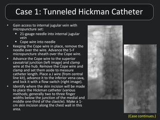 Interventional Radiology Powerpoint.pptx