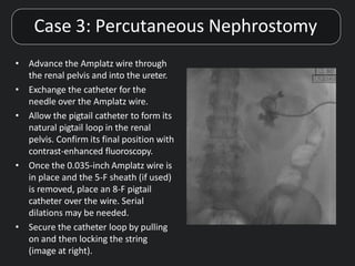 Interventional Radiology Powerpoint.pptx