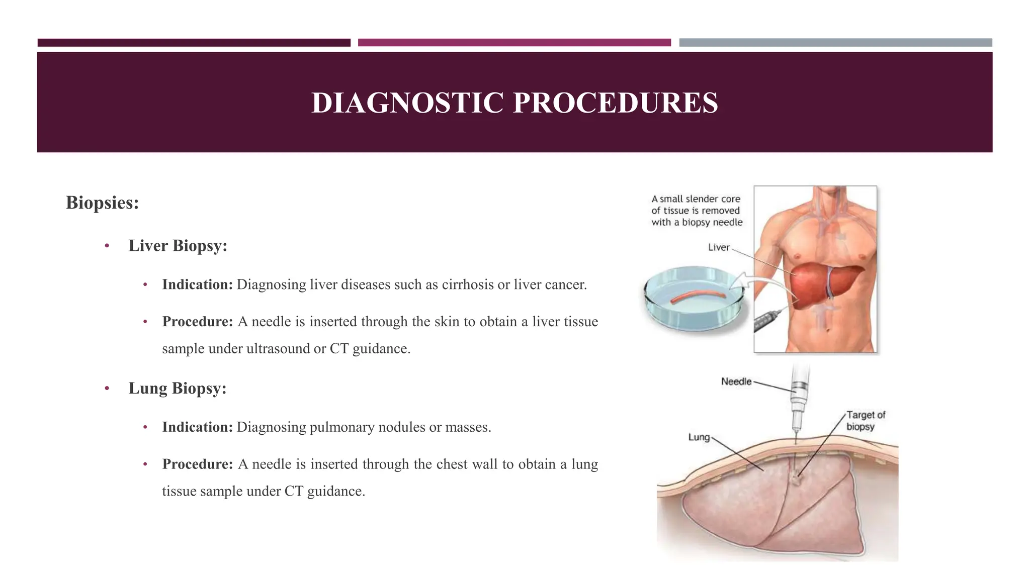 Interventional Radiology Procedures Pptx