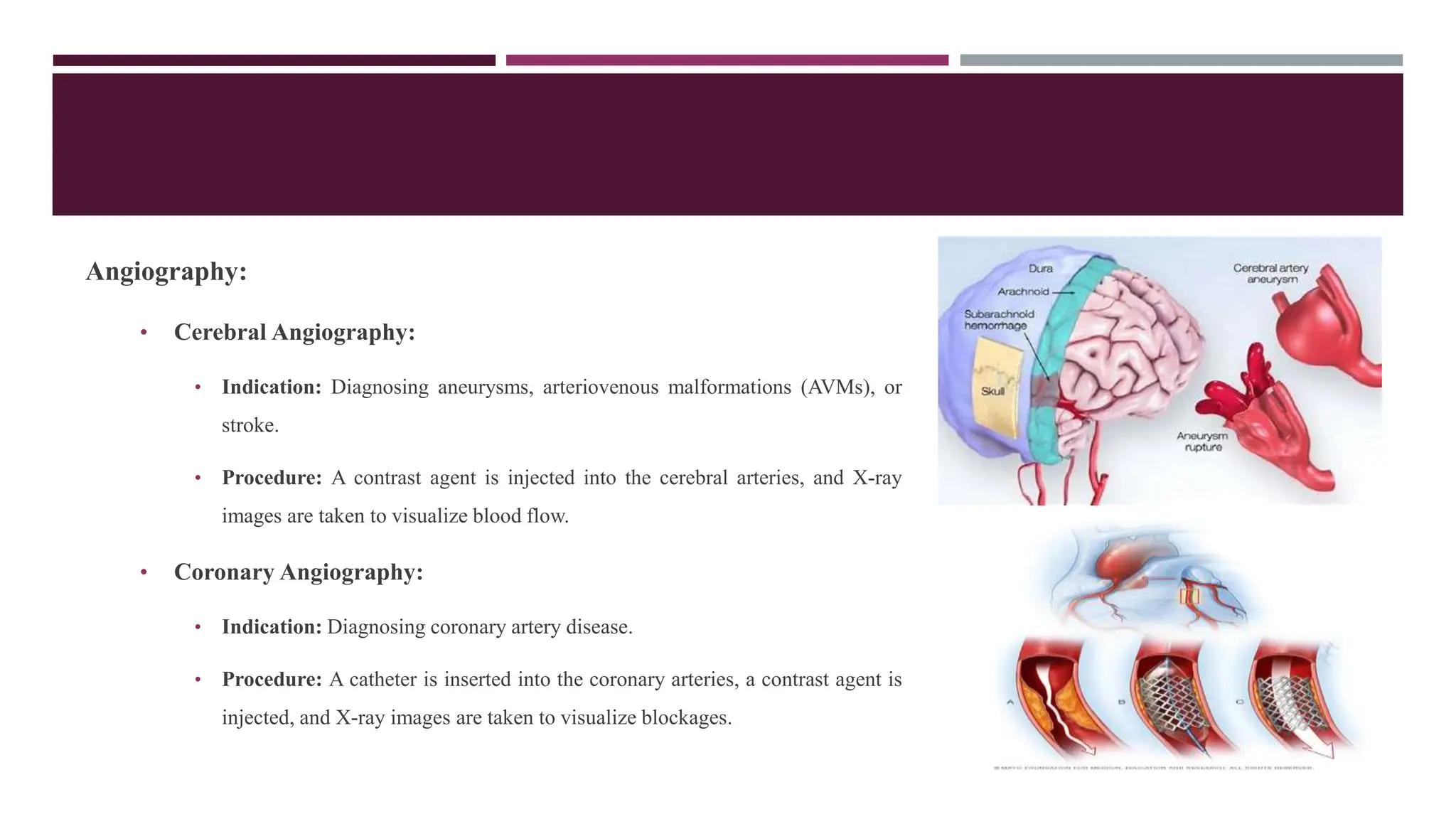Interventional Radiology Procedures.pptx