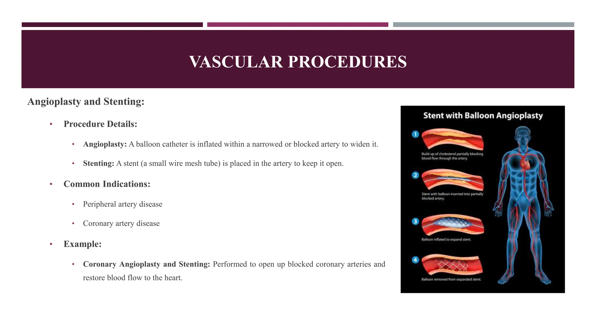 Interventional Radiology Procedures.pptx