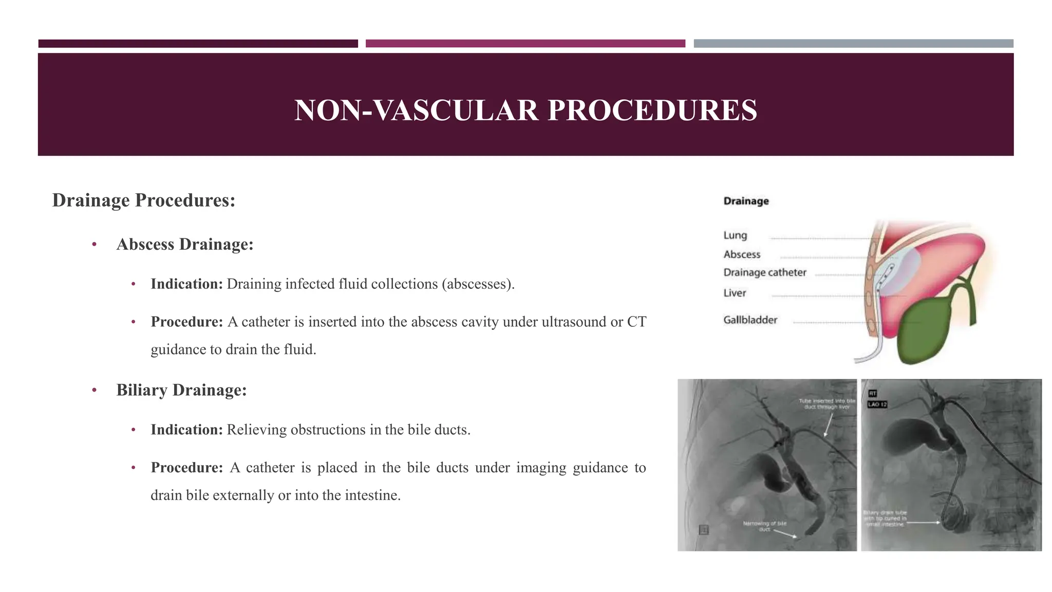 Interventional Radiology Procedures.pptx
