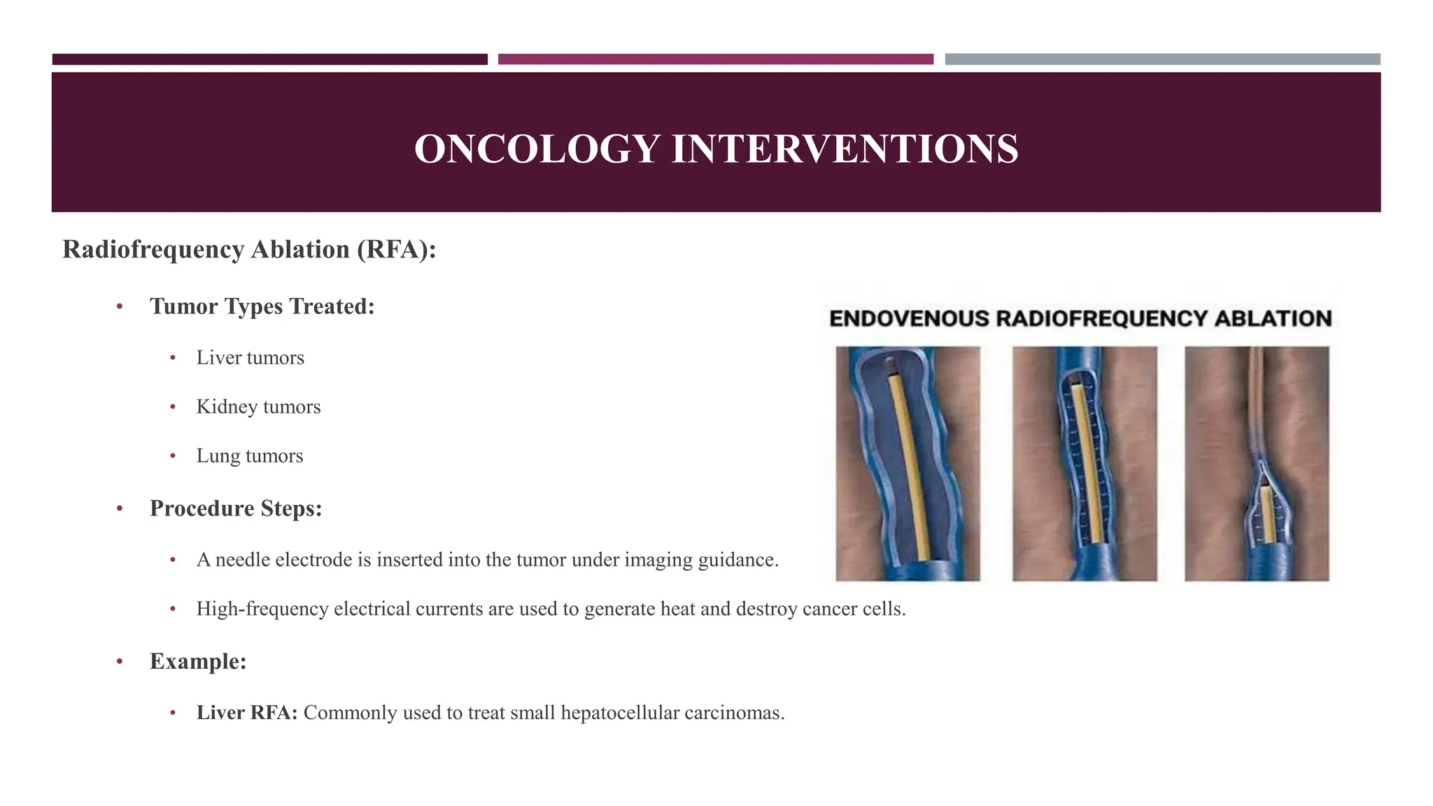 Interventional Radiology Procedures.pptx
