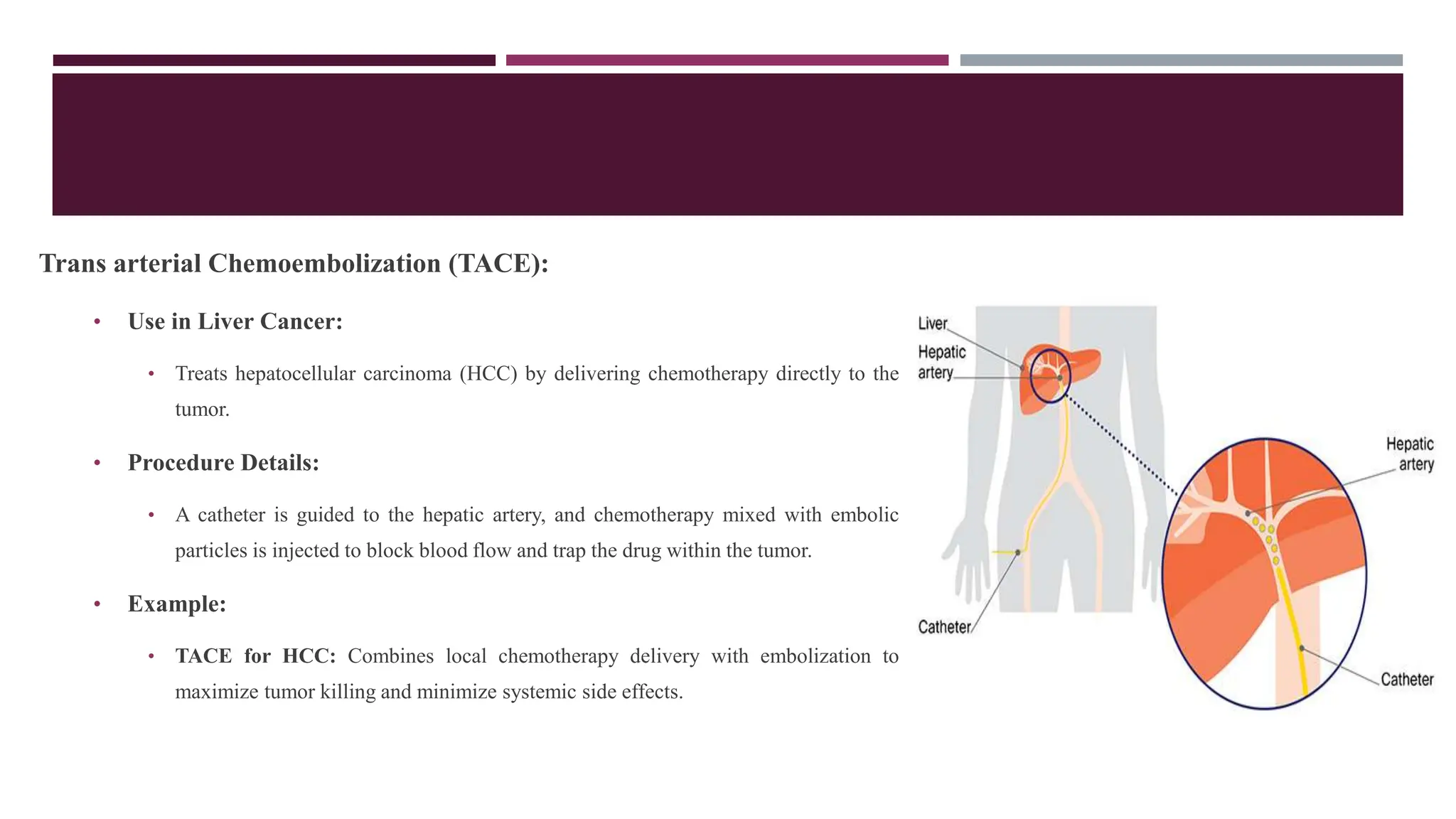 Interventional Radiology Procedures.pptx