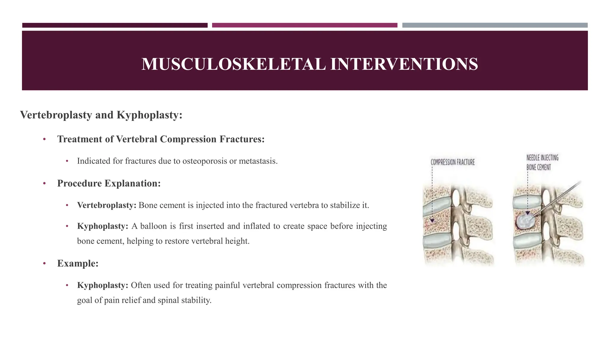 Interventional Radiology Procedures.pptx