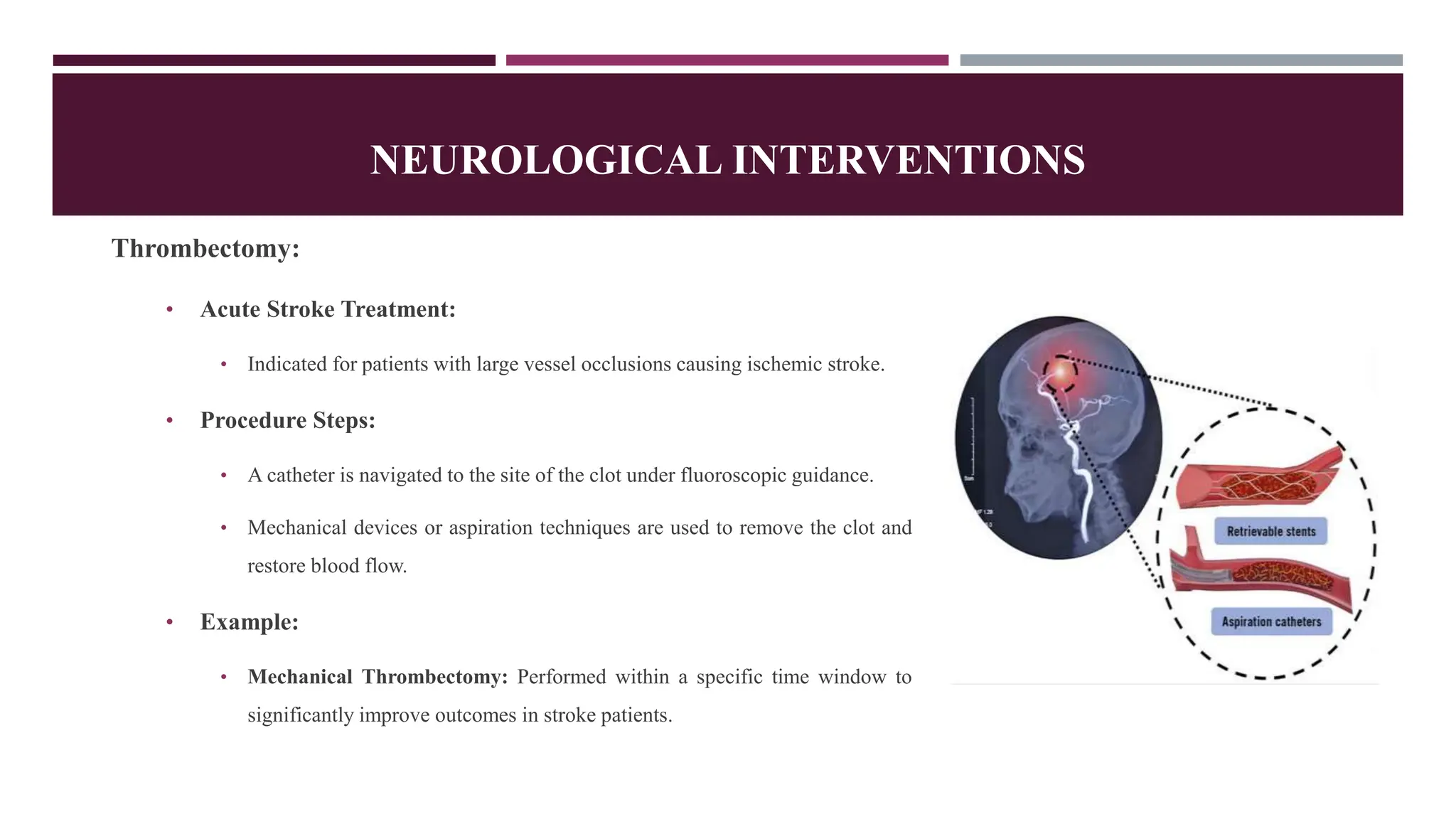 Interventional Radiology Procedures Pptx