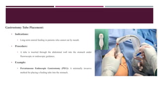 Interventional Radiology Procedures.pptx