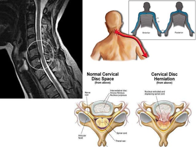 Interventional spine & pain management bhanu.pptx