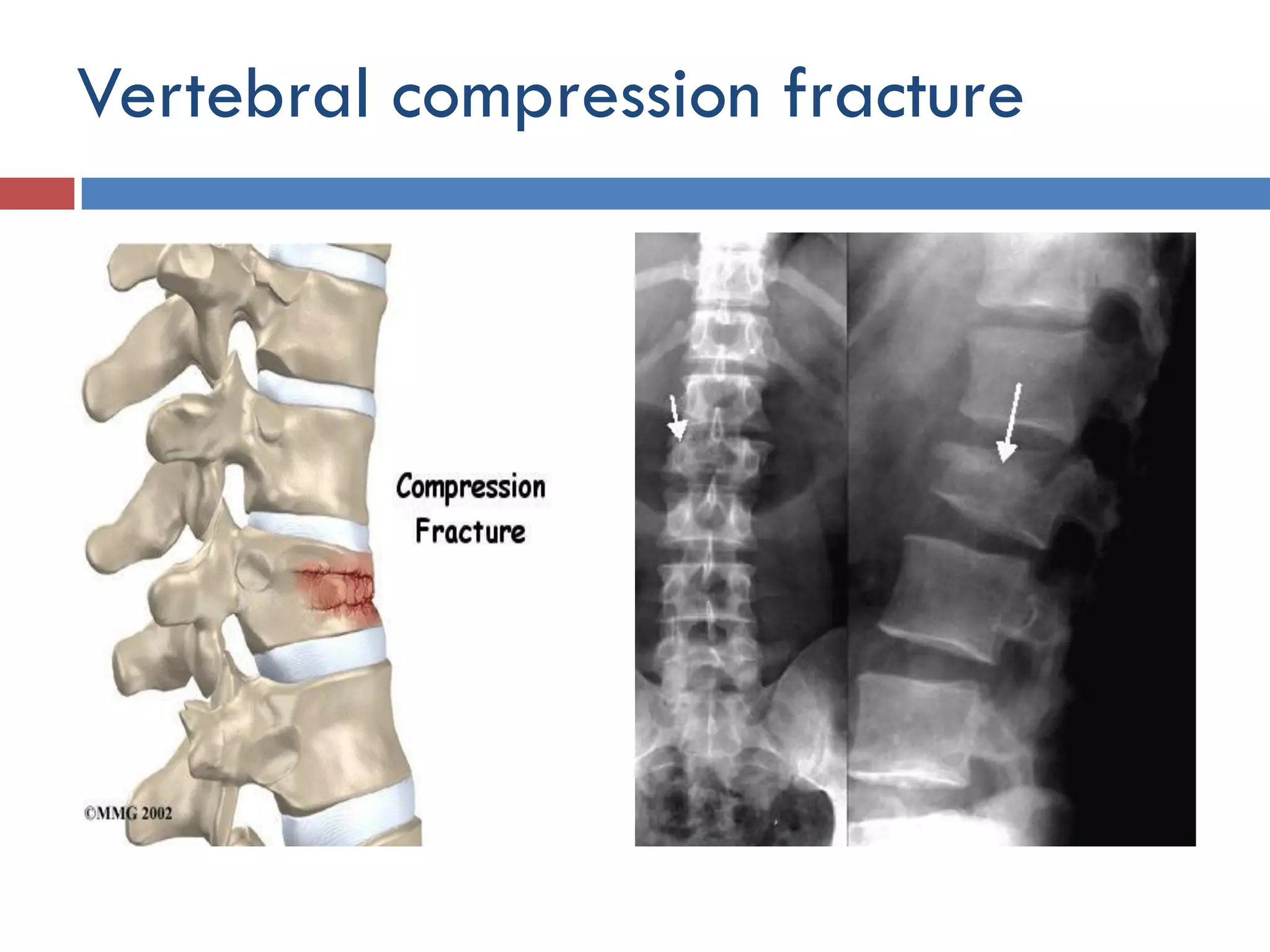 Interventional spine & pain management dr manish raj | PDF