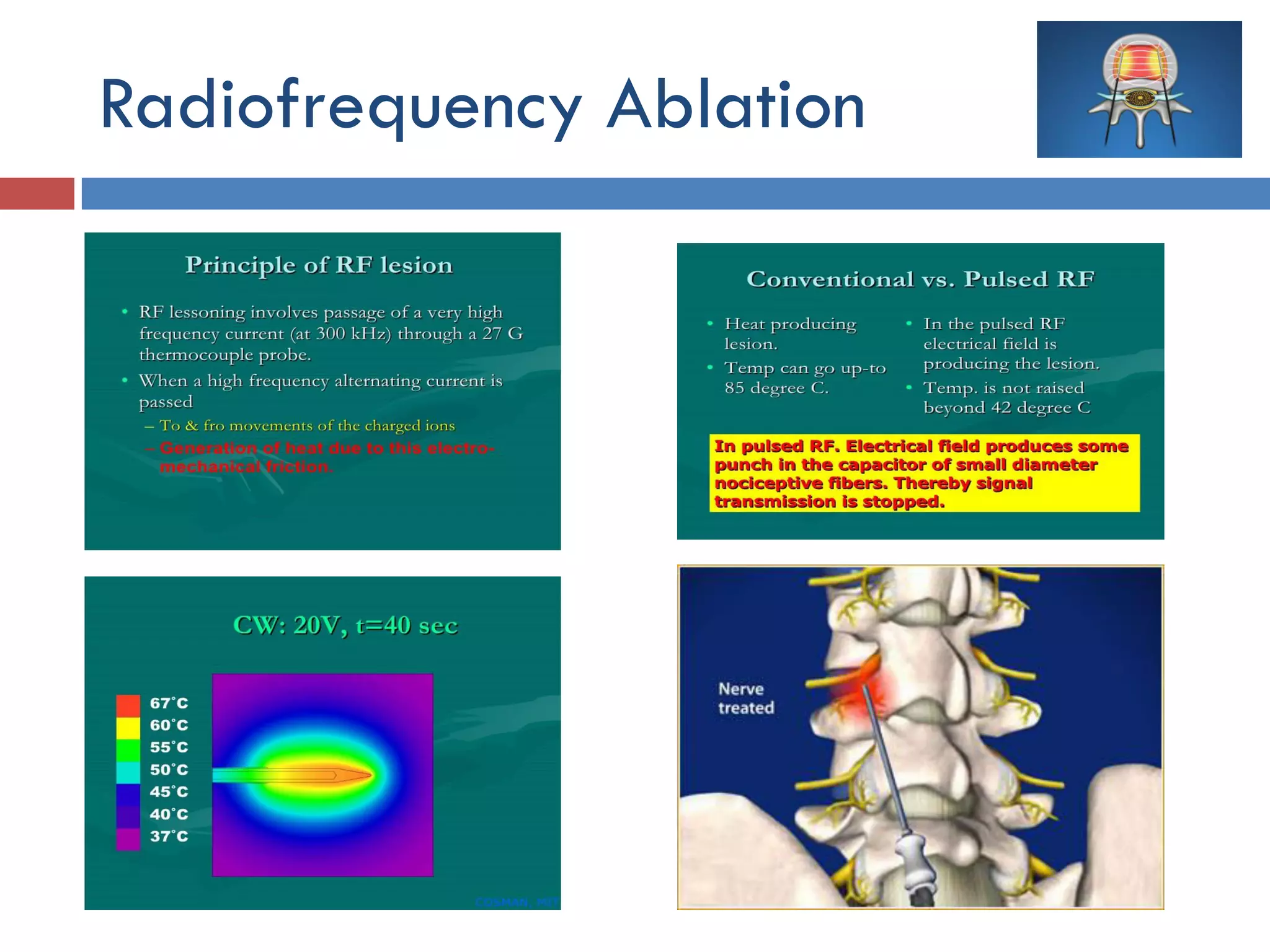 Interventional spine & pain management dr manish raj | PDF